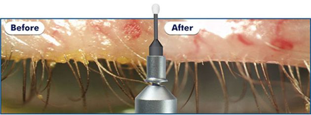 Primary Eye Care – Optometrist in Lexington, KY