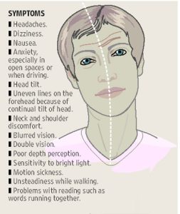 Binocular Vision Dysfunction – Primary Eye Care