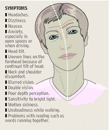 Binocular Vision Dysfunction – Primary Eye Care